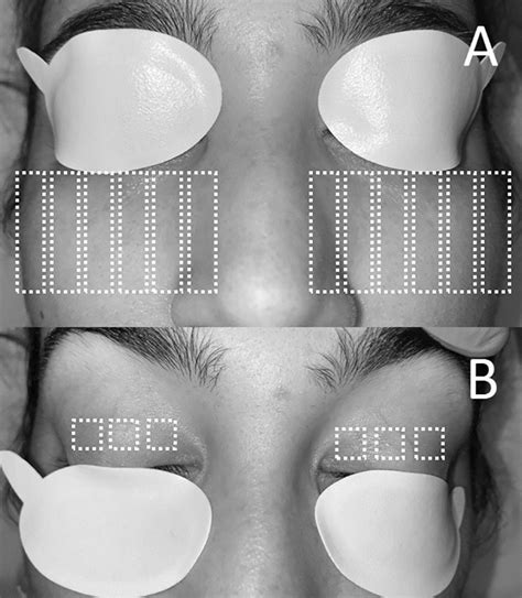 Ipl Protocol A Step 1 B Step 2 Download Scientific Diagram