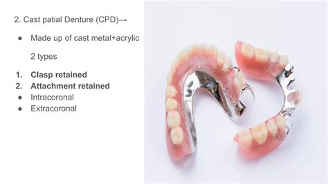 Removable Partial Denture Introduction Part 1 Pdf