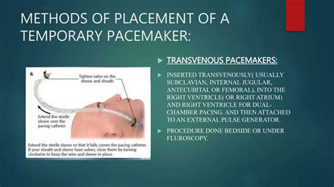 Pace Makers Pptx