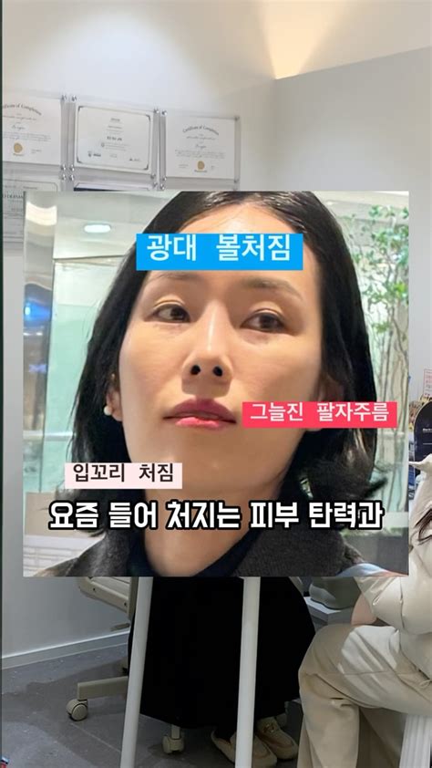 인천피부관리 인천슈퍼젝션 모공소멸연구소 원모어뷰티 나이가 들수록 인위적인 시술이 아닌 자연스러우면서도 우아한 볼륨감있는 피부를 추구하시는 분들이 선택한 관리 💓동안리프팅