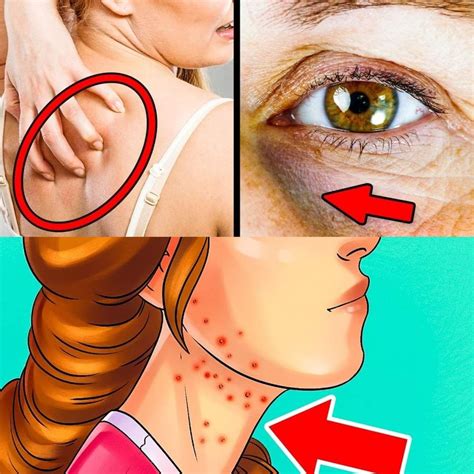 10 Signs You Might Be Consuming Too Much Sugar