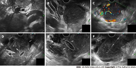 Figure 2 From World Journal Of Gastrointestinal Oncology Semantic Scholar