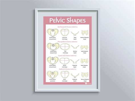 Pelvic Shape Educational Poster Etsy
