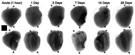 Photographs From The Epicardial Surface Top And Endocardial Surface Download Scientific