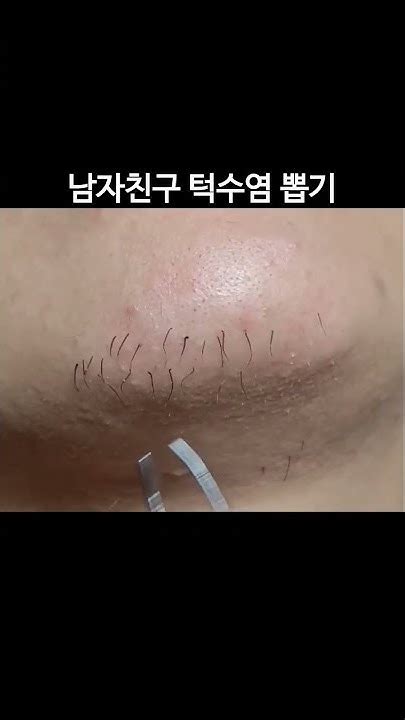 턱수염 뽑기 Youtube