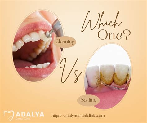 Teeth Scaling Vs Cleaning Key Differences Cost Benefits