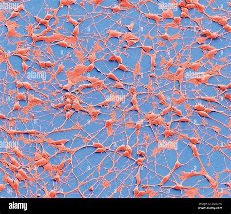 Pluripotent Derived Neurones Coloured Scanning Electron Micrograph Sem Human Neurons