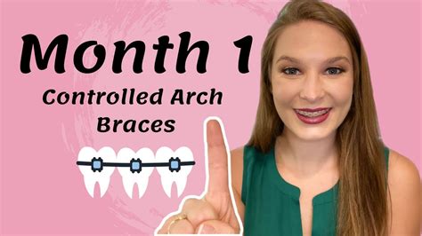 Controlled Arch Braces Month 1 Braces Update Youtube
