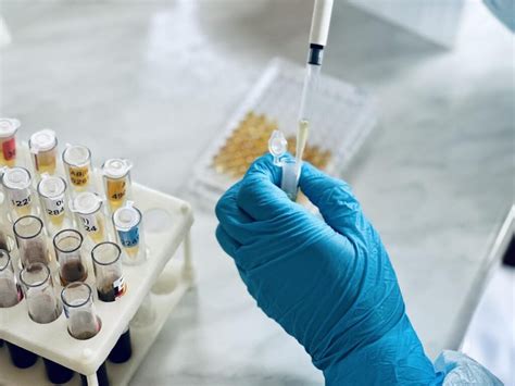 Complement Fixation Test Principle Procedure Results