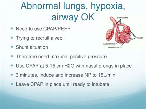 Delayed Sequence Intubation
