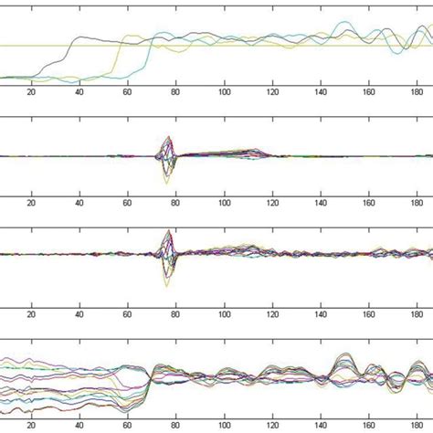Results Of 12 Lead Ecg With Mcmc Top Atrial Part Of Tmp 2nd Download Scientific Diagram