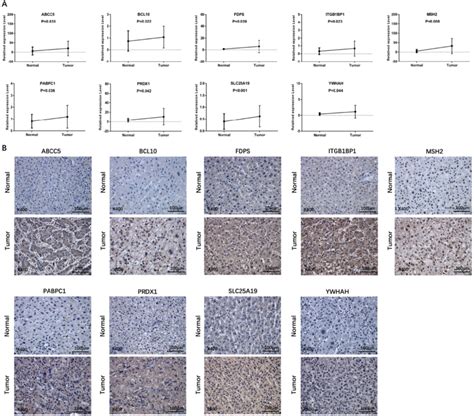 Verification Of The Expression Level Of Prognostic Genes Between Hcc