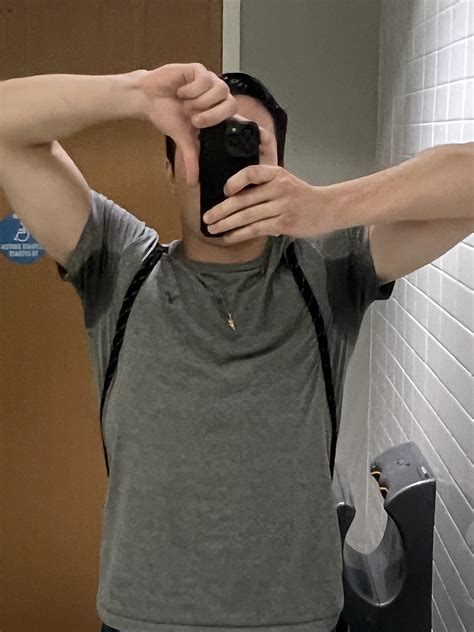 Recommend Otc Antiperspirant R Hyperhidrosis