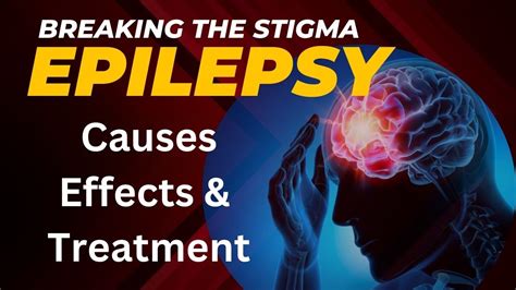 Understanding Epilepsy Types Causes Effects And Treatments