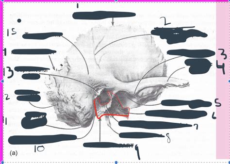Temporal Bone Lateral View Diagram Quizlet