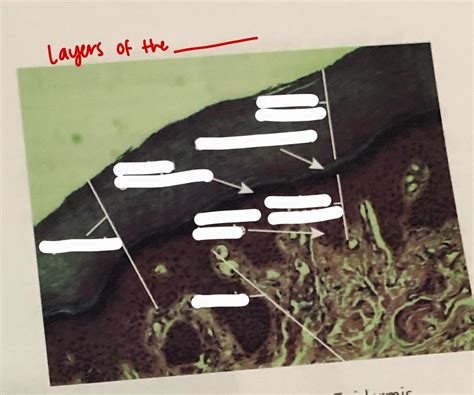 Layers Of The Epidermis Microscope Slides Diagram Quizlet