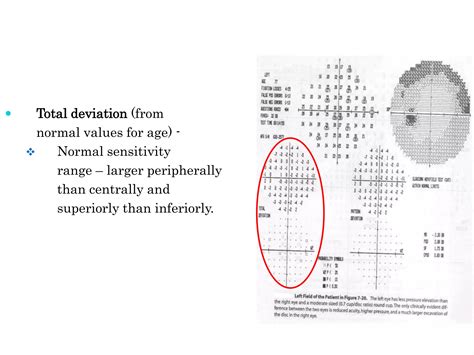 Visual Field Analysis Ppt
