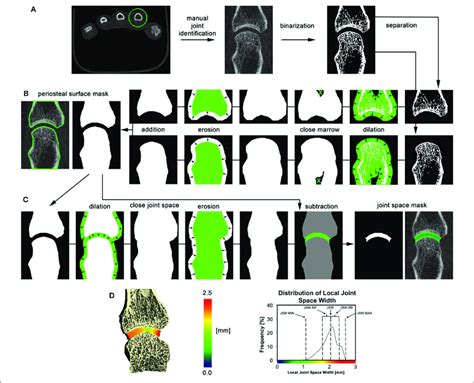 3d Volumetric Joint Space Width Analysis By Hr Pqct A The Relevant Download Scientific
