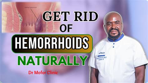 Hemorrhoid Treatment Lubbock Tx At John Lindgren Blog
