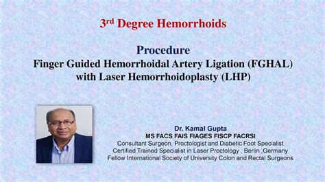 3rd Degree Hemorrhoids Youtube