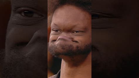 Worlds Smallest Lips