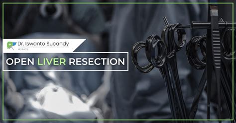 Open Liver Resection Open Liver Surgery Visit Our Tampa Liver Center
