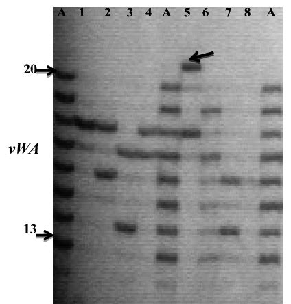 Variant VWA Paired With VWA Allele Sample At VWA Locus Download Scientific