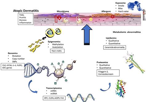 Frontiers Leveraging Multilayered Omics Data For Atopic Dermatitis