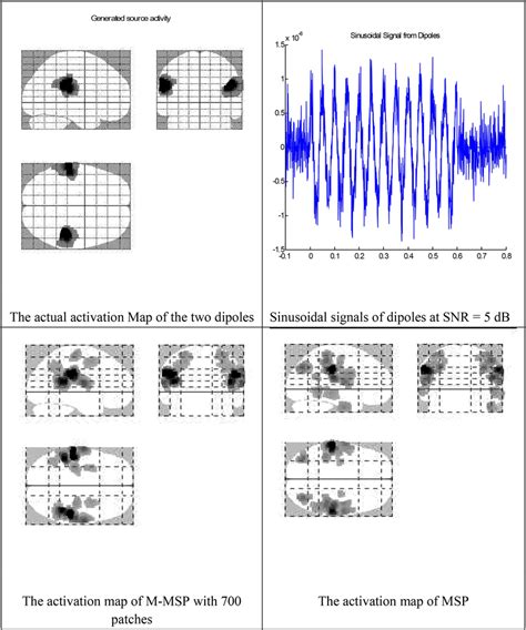 Activation Maps For MSP And MMSP With 700 Patches Color Figure Can Be Download Scientific