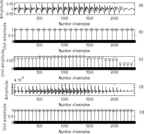 figure 7 from improving the intelligibility of dysarthric speech by