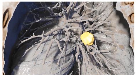 医学可视化应用简介volview Csdn博客