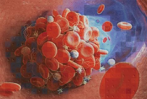 Machine Learning Solves A Sticky Problem Elife Science Digests Elife