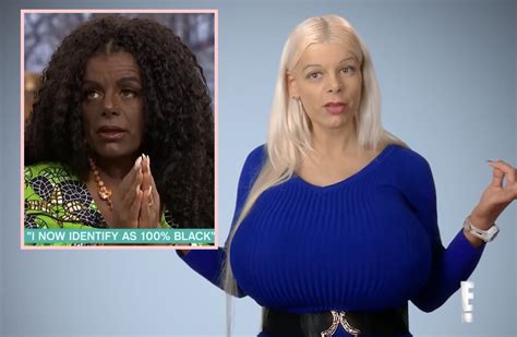 White Model From Botched Identifies As Black Now And Plans To Move To