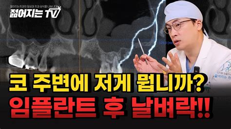 임플란트 한 후에 축농증이 생겼다고요ㅣ임플란트 부작용 Youtube