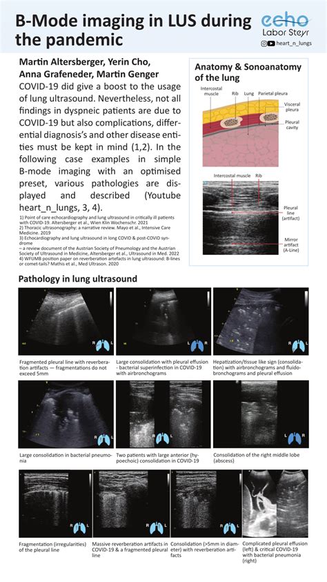 Pdf B Mode Imaging In Lus During The Pandemic