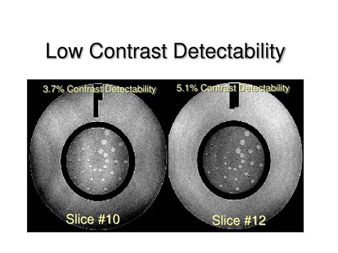 Ppt Quality Control And The Acrs Mri Accreditation Program Powerpoint Presentation Id1468261