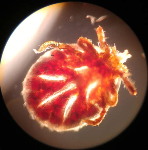 NJ I Found This Bug Attached To My Genitals Please Help X Magnification R Whatsthisbug