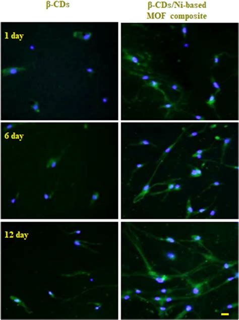 Fluorescent Microscopy Of Cells Seeded On B Cds And B Cds Ni Based Mof Download Scientific