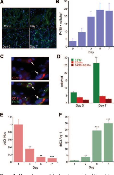 Figure From Distinct Macrophage Phenotypes Contribute To Kidney Injury And Repair Semantic