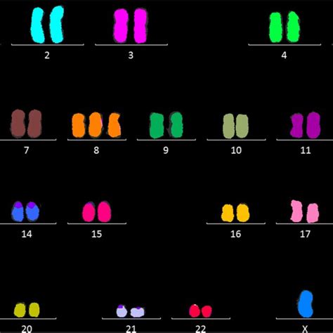 Color Karyotyping Of The Oci Aml3 Cell Line Leading To The Iscn