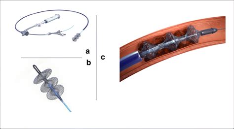 A Flowtriever Embolectomy System Inari Medical Irvine Ca B