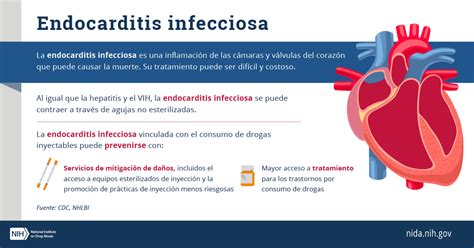 Signos De Endocarditis Infecciosa