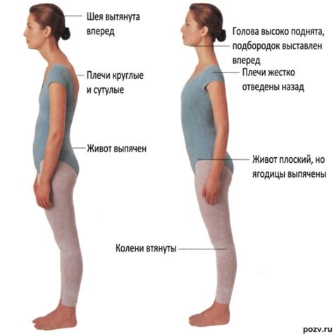 Шейный лордоз причины симптомы лечение фото