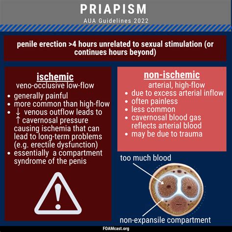 Acute Ischemic Priapism Foamcast