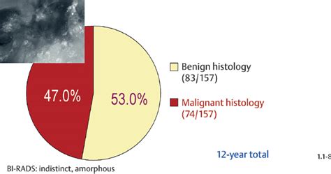 Overview Of The Diagnostic And Management Problems Encountered When Malignant Type