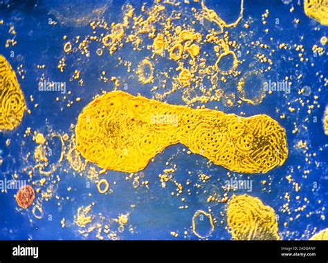 False Colour Transmission Electron Micrograph Tem Of Cytoplasm Of A Protozoan Paramecium Sp