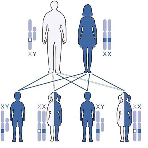 What Is Mecp2 Duplication Syndrome Gazing Off Into Space