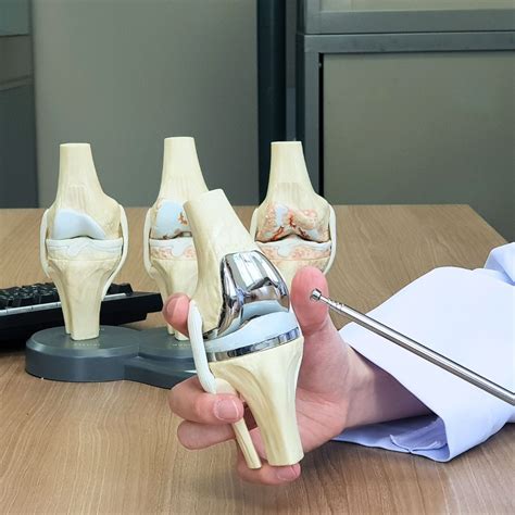 Drandreolivier Newlimborthopeadics Vergelegenmediclinic Somersetwest Kneereplacement