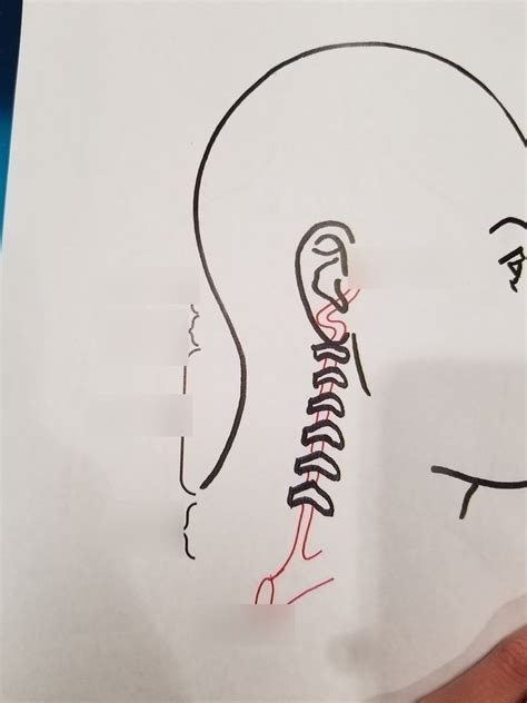 Diagram Of Mod 1 Vertebral Artery Segments Quizlet