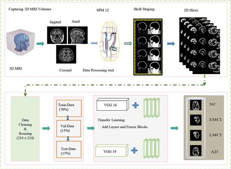 Frontiers A Transfer Learning Approach For Multiclass Classification Of Alzheimers Disease